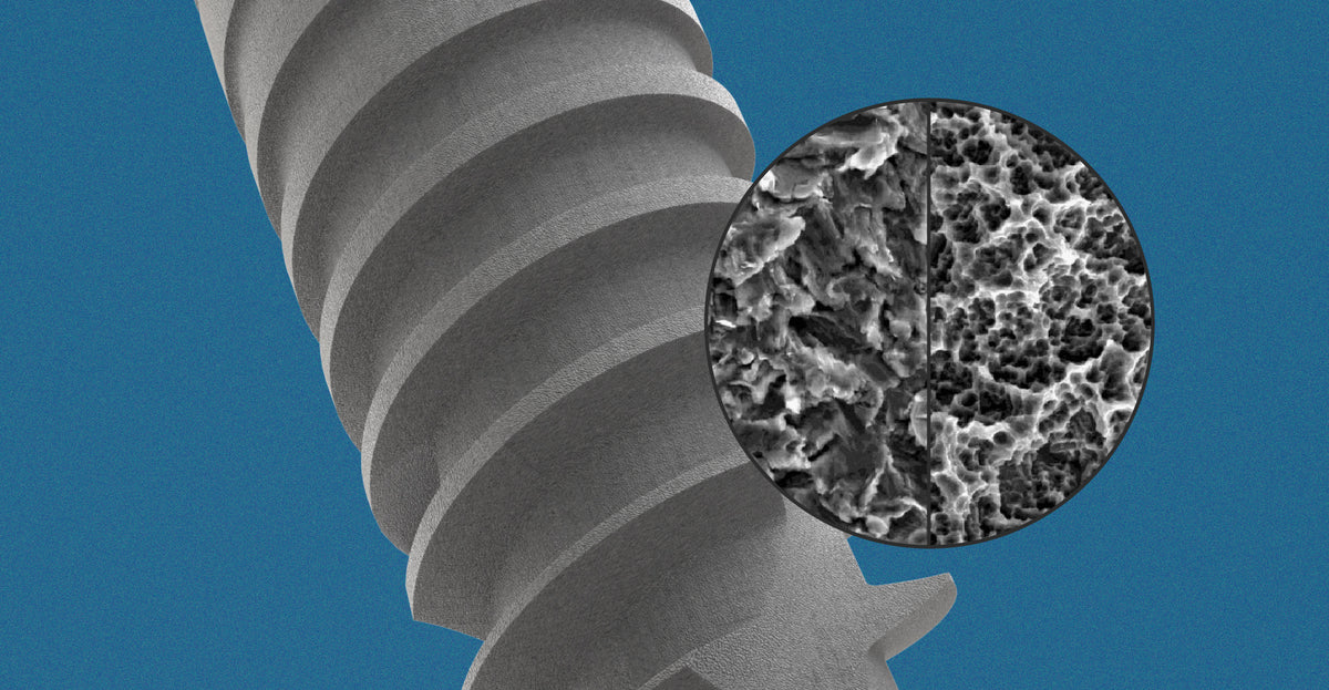 Surface Treatments for Dental Implants: SLA vs. RBM – OEMDent